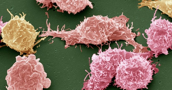 Amivantamab plus chemotherapy with and without lazertinib in EGFR ...