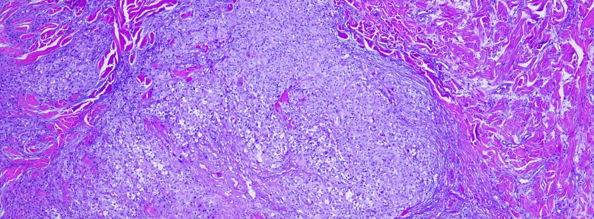 Pharmacist’s Application to Practice: Hepzato Kit™ | HOPA