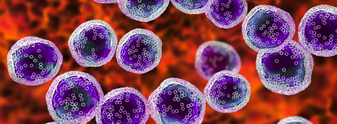 Axicabtagene Ciloleucel as Second-Line Therapy for Large B-Cell ...